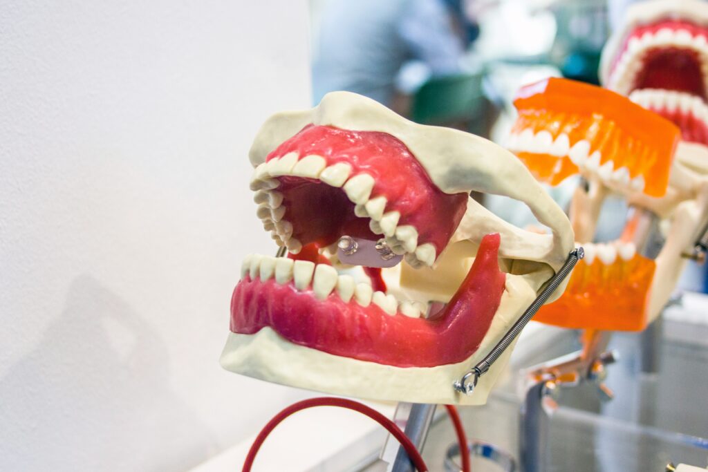 Dental Headgear: Types, Cost, and Use - Good Dental Plan